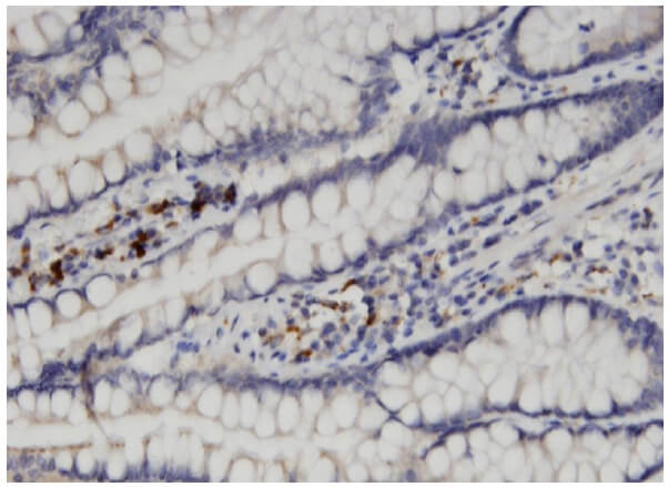 GnT-V Antibody (3E9) | SCBT - Santa Cruz Biotechnology