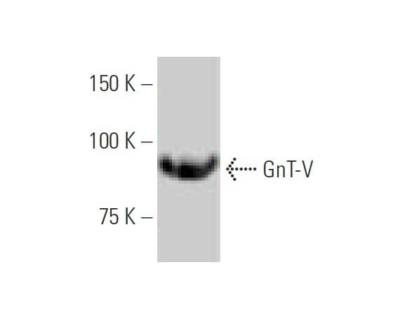 GnT-V Antibody (3E9) | SCBT - Santa Cruz Biotechnology