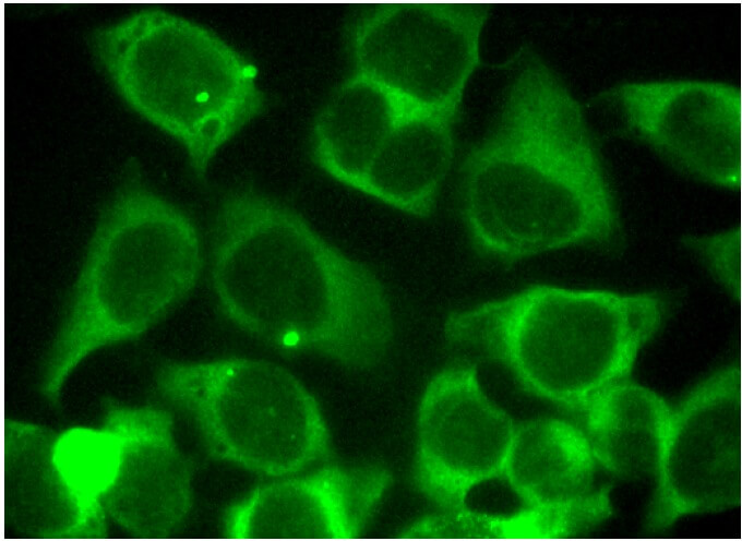 goat anti-mouse IgG-FITC Secondary Antibody | SCBT - Santa Cruz ...