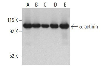 goat anti-mouse IgG-HRP Secondary Antibody | SCBT - Santa Cruz ...