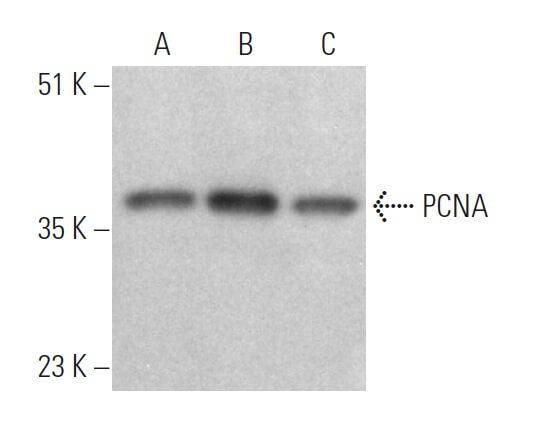 goat anti-rabbit IgG-HRP Secondary Antibody | SCBT - Santa Cruz ...