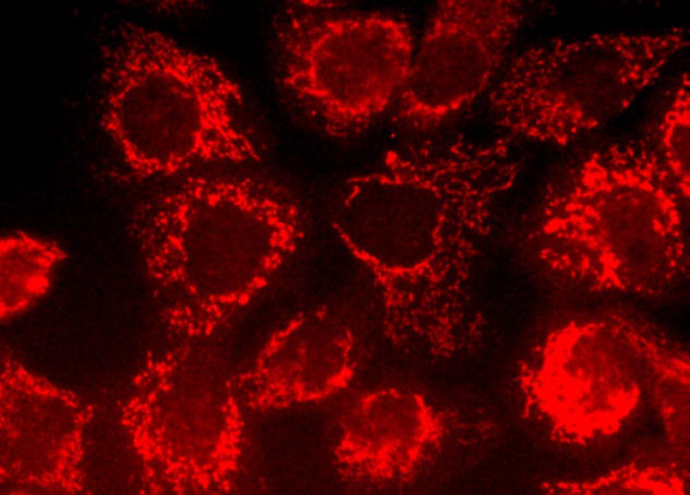 goat anti-rabbit IgG-PE Secondary Antibody | SCBT - Santa Cruz ...