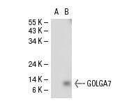GOLGA7抗体 (NO-2) | SCBT - Santa Cruz Biotechnology