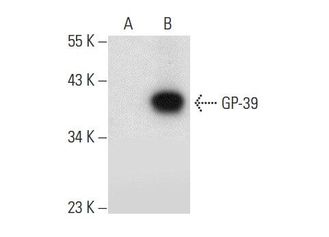 GP-39 Antibody (A-10) | SCBT - Santa Cruz Biotechnology