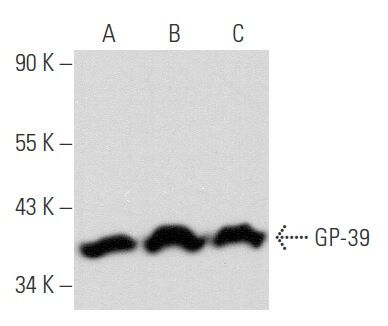 GP-39 Antibody (E-10) | SCBT - Santa Cruz Biotechnology