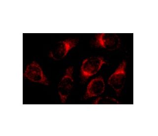gp130 Antibody (AN-H2) | SCBT - Santa Cruz Biotechnology