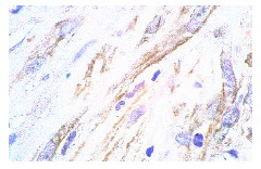 gp130 Antibody (AN-H2) | SCBT - Santa Cruz Biotechnology