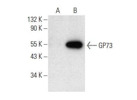 GP73 Antibody (G-2) | SCBT - Santa Cruz Biotechnology