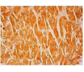 GPD2 Antibody (D-12) - Immunohistochemistry - Image 304077