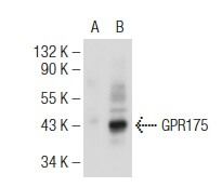GPR175 Antibody (6H2) | SCBT - Santa Cruz Biotechnology