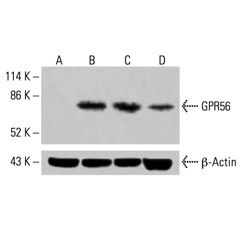GPR56抗体 (G-6) | SCBT - Santa Cruz Biotechnology