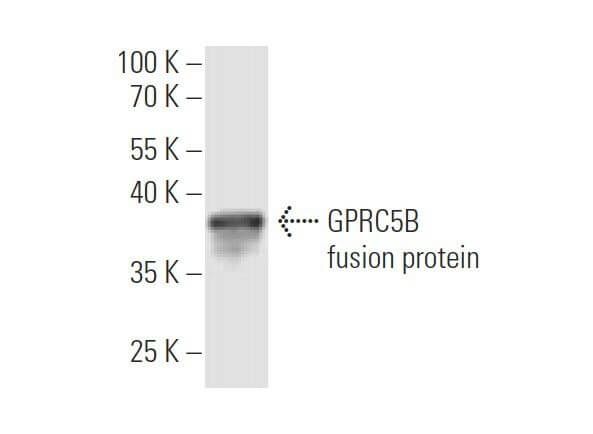 GPRC5B Antibody (1H1) | SCBT - Santa Cruz Biotechnology