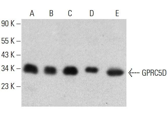GPRC5D抗体 (E-2) | SCBT - Santa Cruz Biotechnology
