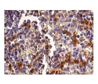 granzyme B Antibody (2C5) - Immunohistochemistry - Image 156308