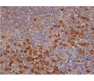 granzyme B Antibody (2C5) - Immunohistochemistry - Image 365249