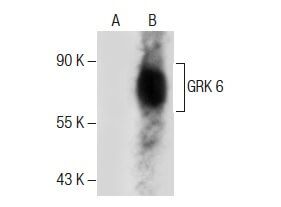 GRK 6 Antibody (D-10) | SCBT - Santa Cruz Biotechnology