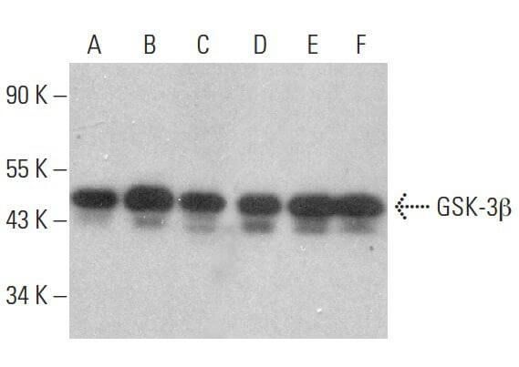 GSK3 beta Antibody (E-11) | SCBT - Santa Cruz Biotechnology