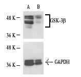 GSK3 beta siRNA (h), shRNA and Lentiviral Particle Gene Silencers ...