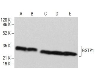 GSTP1 Antibody (3F2C2) - Western Blotting - Image 354955