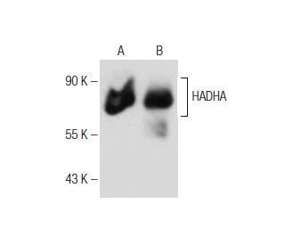 HADHA Antibody (E-8) - Western Blotting - Image 151058
