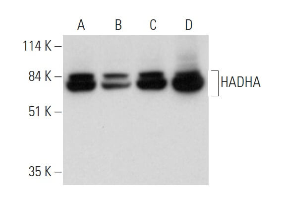 Anti-HADHA Antibody (E-8) | SCBT - Santa Cruz Biotechnology