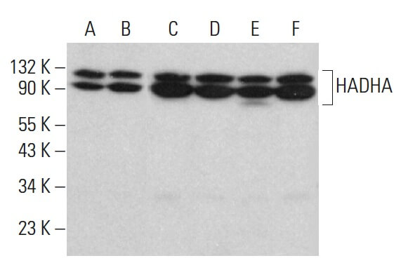 Anti-HADHA Antibody (E-8) | SCBT - Santa Cruz Biotechnology