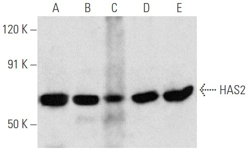 HAS2 Antibody (A-7) | SCBT - Santa Cruz Biotechnology