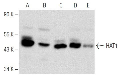 HAT1 Antibody (G-12) | SCBT - Santa Cruz Biotechnology