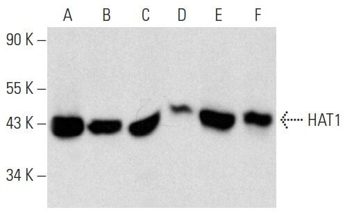 HAT1 Antibody (H-7) | SCBT - Santa Cruz Biotechnology