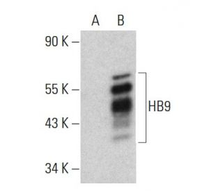 HB9 Antibody (F-5) - Western Blotting - Image 364779