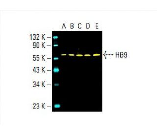 HB9 Antibody (F-5) - Western Blotting - Image 392789