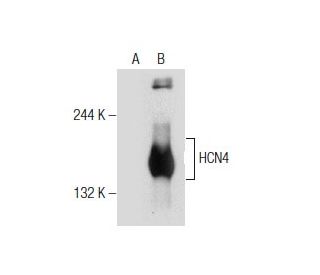HCN4 Antibody (SHG 1E5) - Western Blotting - Image 155370
