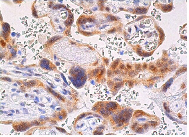 HDAC1 Antibody (10E2) | SCBT - Santa Cruz Biotechnology