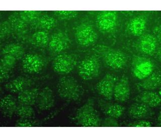Anti-Histone Deacetylase 11 (HDAC11) Antibody (C-5) | SCBT - Santa Cruz ...