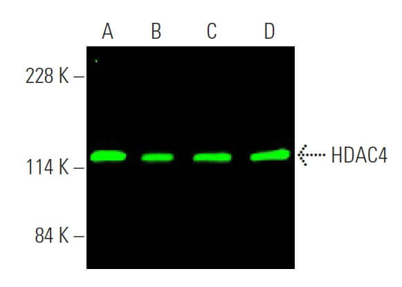 Histone Deacetylase 4 (HDAC4) Antibody (A-4) | SCBT - Santa Cruz ...