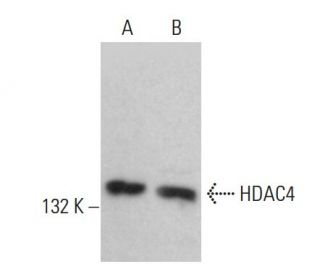 HDAC4 Antibody (A-4) - Western Blotting - Image 380440