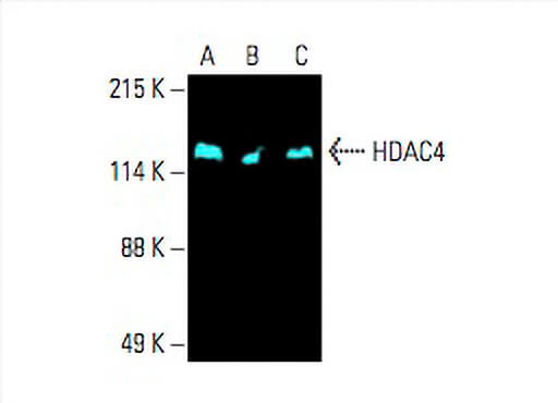 Histone Deacetylase 4 (HDAC4) Antibody (A-4) | SCBT - Santa Cruz ...