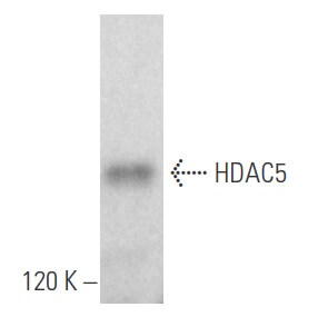 Anti-Histone Deacetylase 5 (HDAC5) Antibody (C-11) | SCBT - Santa Cruz ...