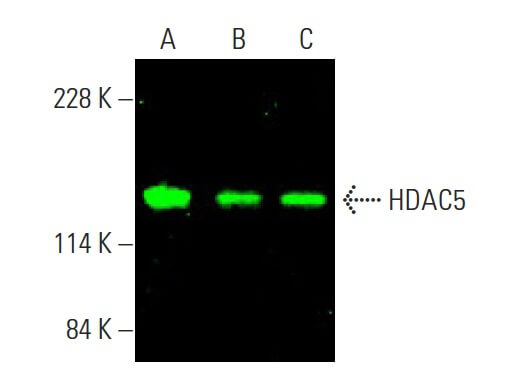 Anti-Histone Deacetylase 5 (HDAC5) Antibody (C-11) | SCBT - Santa Cruz ...