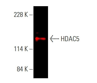 Anti-Histone Deacetylase 5 (HDAC5) Antibody (C-11) | SCBT - Santa Cruz ...