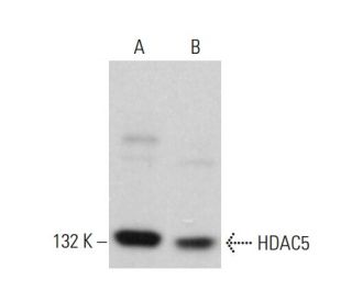 Anti-Histone Deacetylase 5 (HDAC5) Antibody (C-11) | SCBT - Santa Cruz ...
