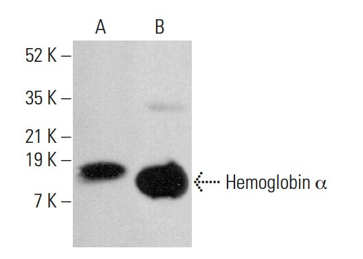 Anti-Hemoglobin α Antibody (B-10) | SCBT - Santa Cruz Biotechnology