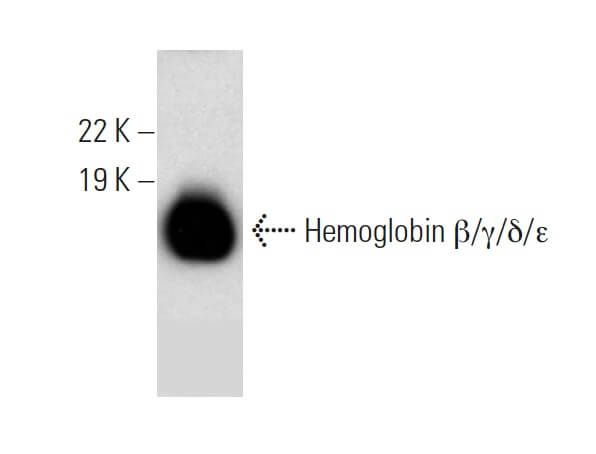 Hemoglobin β/γ/δ Antibody (H-76) | SCBT - Santa Cruz Biotechnology