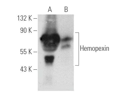 Hemopexin Antibody (F-12) | SCBT - Santa Cruz Biotechnology