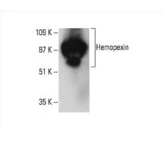 Hemopexin Antibody (F-12) | SCBT - Santa Cruz Biotechnology