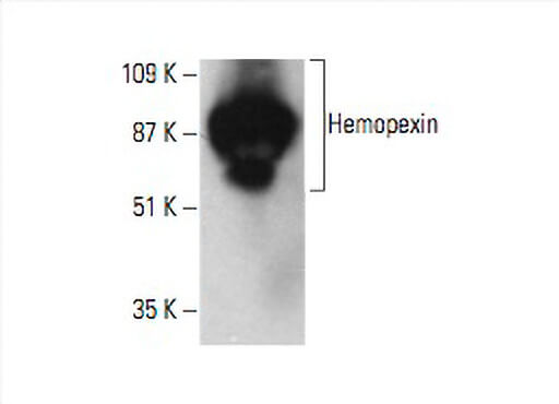 Hemopexin Antibody (F-12) | SCBT - Santa Cruz Biotechnology