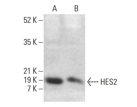 HES2 Antibody (H-8) | SCBT - Santa Cruz Biotechnology