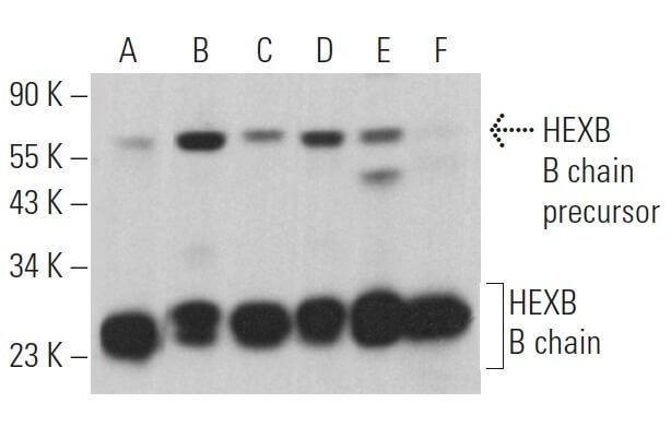 HEXB B chain抗体 (D-9) | SCBT - Santa Cruz Biotechnology