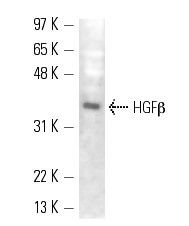 HGFβ Antibody (SBF5 C1.7) | SCBT - Santa Cruz Biotechnology