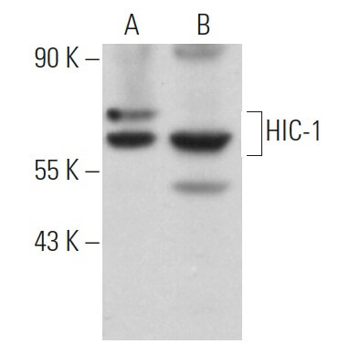 Anti-HIC-1 Antibody (H-6) | SCBT - Santa Cruz Biotechnology
